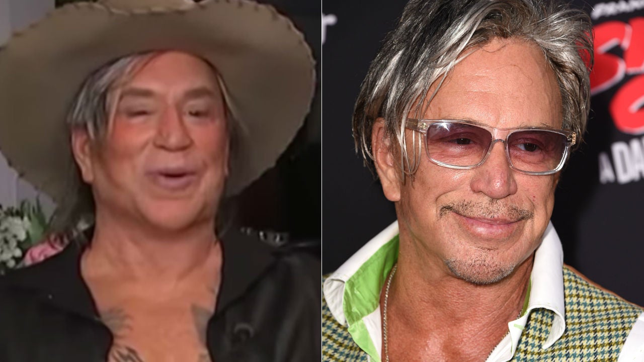 Mickey Rourke Boxing Injuries