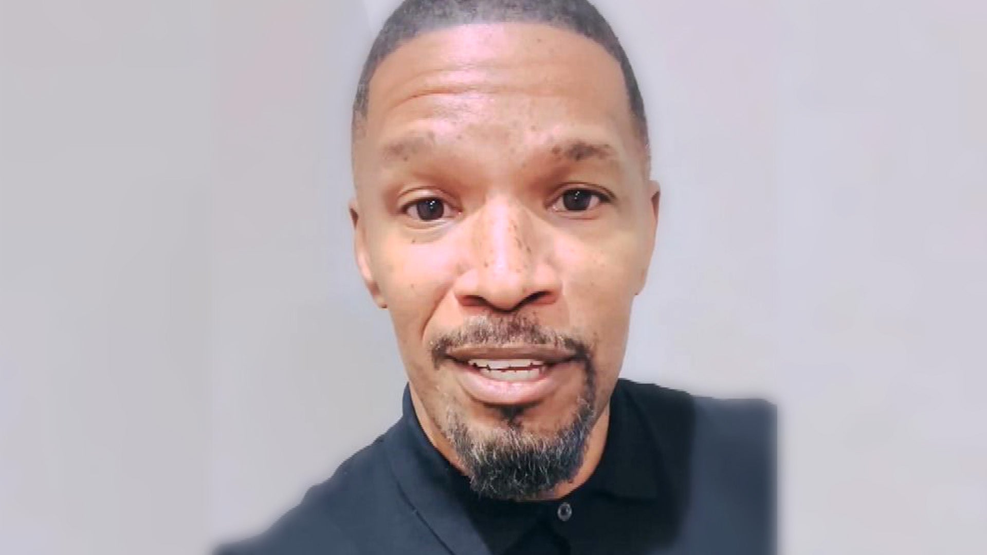Jamie Foxx Hair Transplant