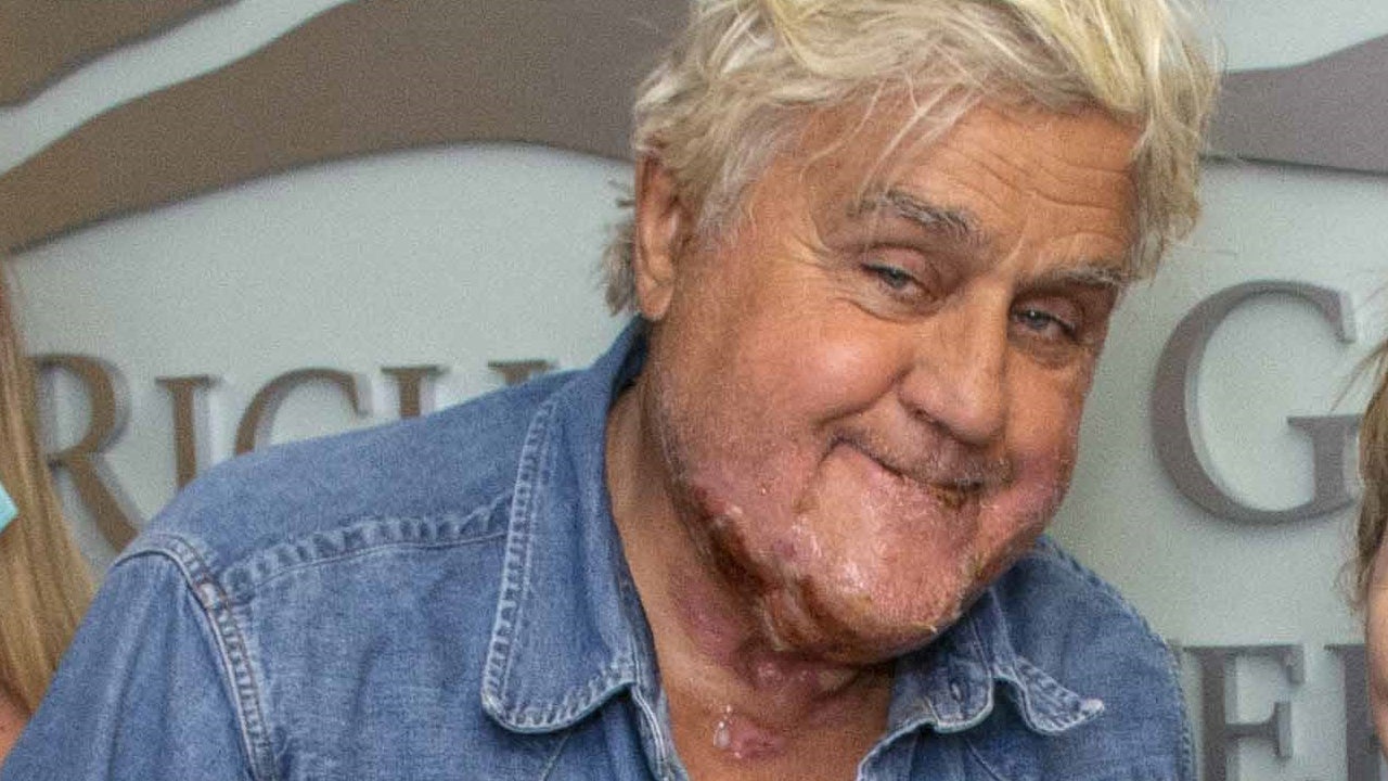 Jay Leno Seen in First Photo Since Suffering 3rd-Degree Burns and Being ...