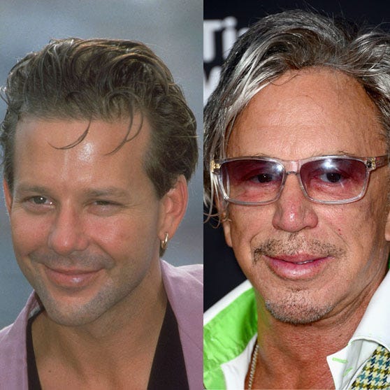 Before & After: Celebs' Most Dramatic Transformations | Entertainment ...