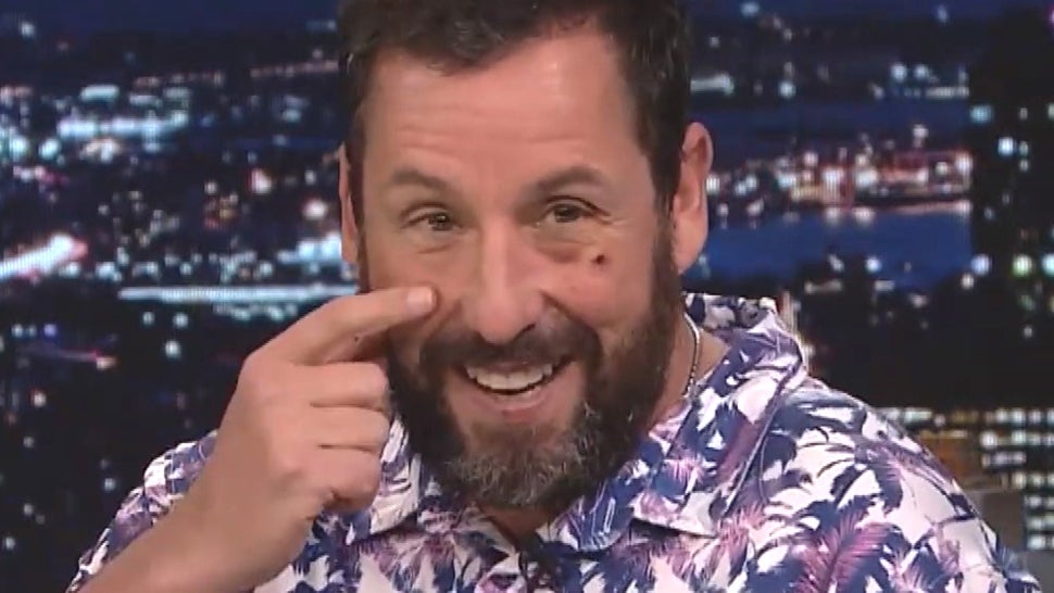 Adam Sandler Walks With a Cane After Undergoing Hip Surgery ...