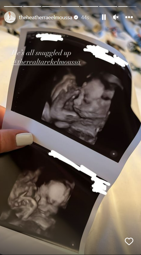 Heather Rae El Moussa Gives Baby Update, Shares Ultrasound Photos ...