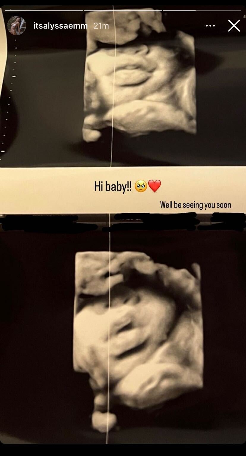 Alyssa Scott Posts Ultrasound Photos of Second Baby with Nick Cannon ...