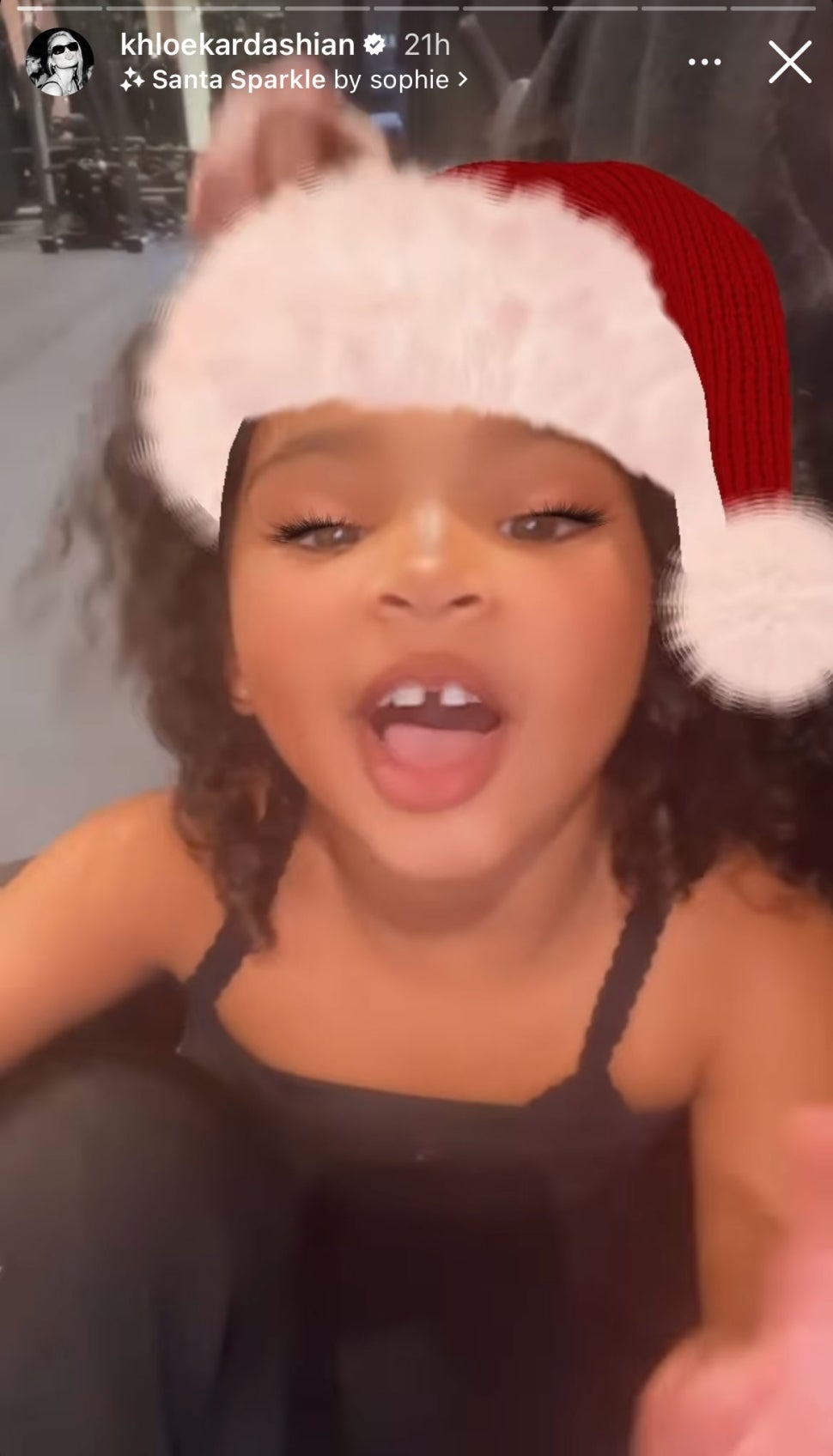 Khloe Kardashian's Daughter True Loses Her First Tooth: See the Cute ...