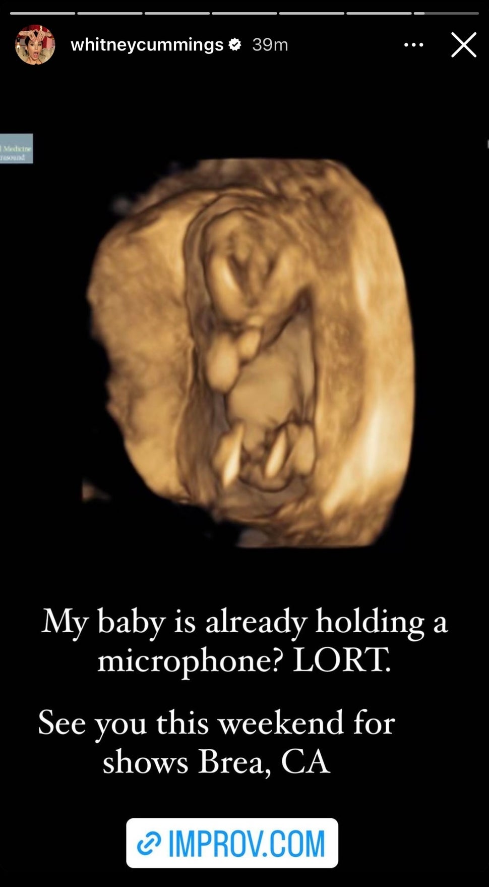 Whitney Cummings Announces She's Pregnant With First Child -- See Her Baby Bump | Entertainment ...