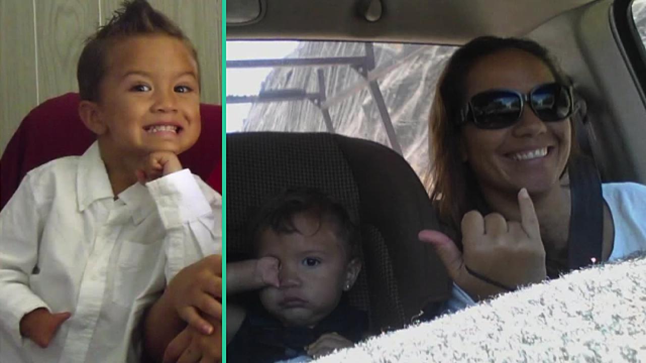 A 3-Year-Old Boy Born Without Fingers Got an Awesome 'Iron Man' Hand ...