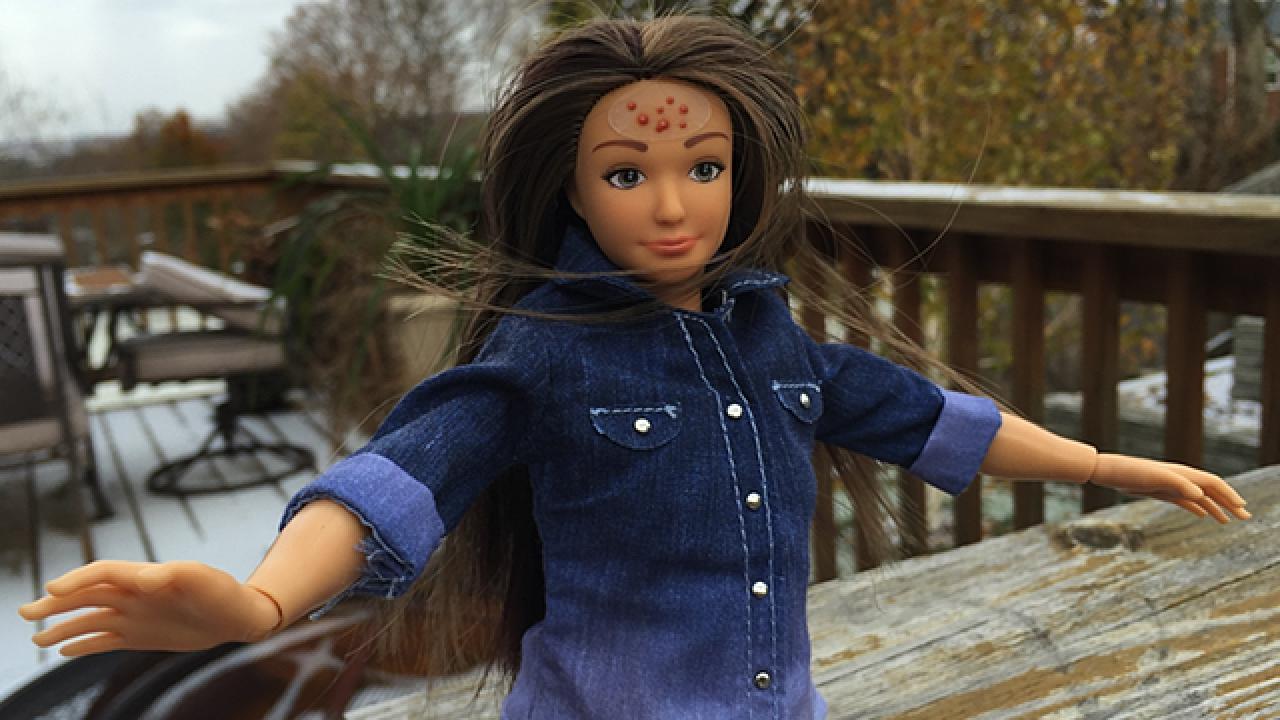 Meet Normal Barbie, the Doll With Cellulite and Acne That Proves ...
