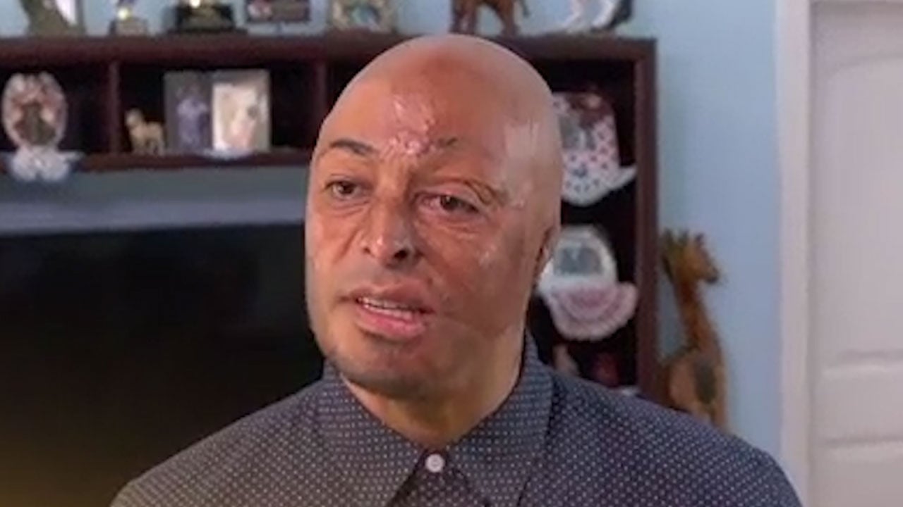 EXCLUSIVE: 'DWTS' Champ J.R. Martinez Admits He Had Doubts About His ...