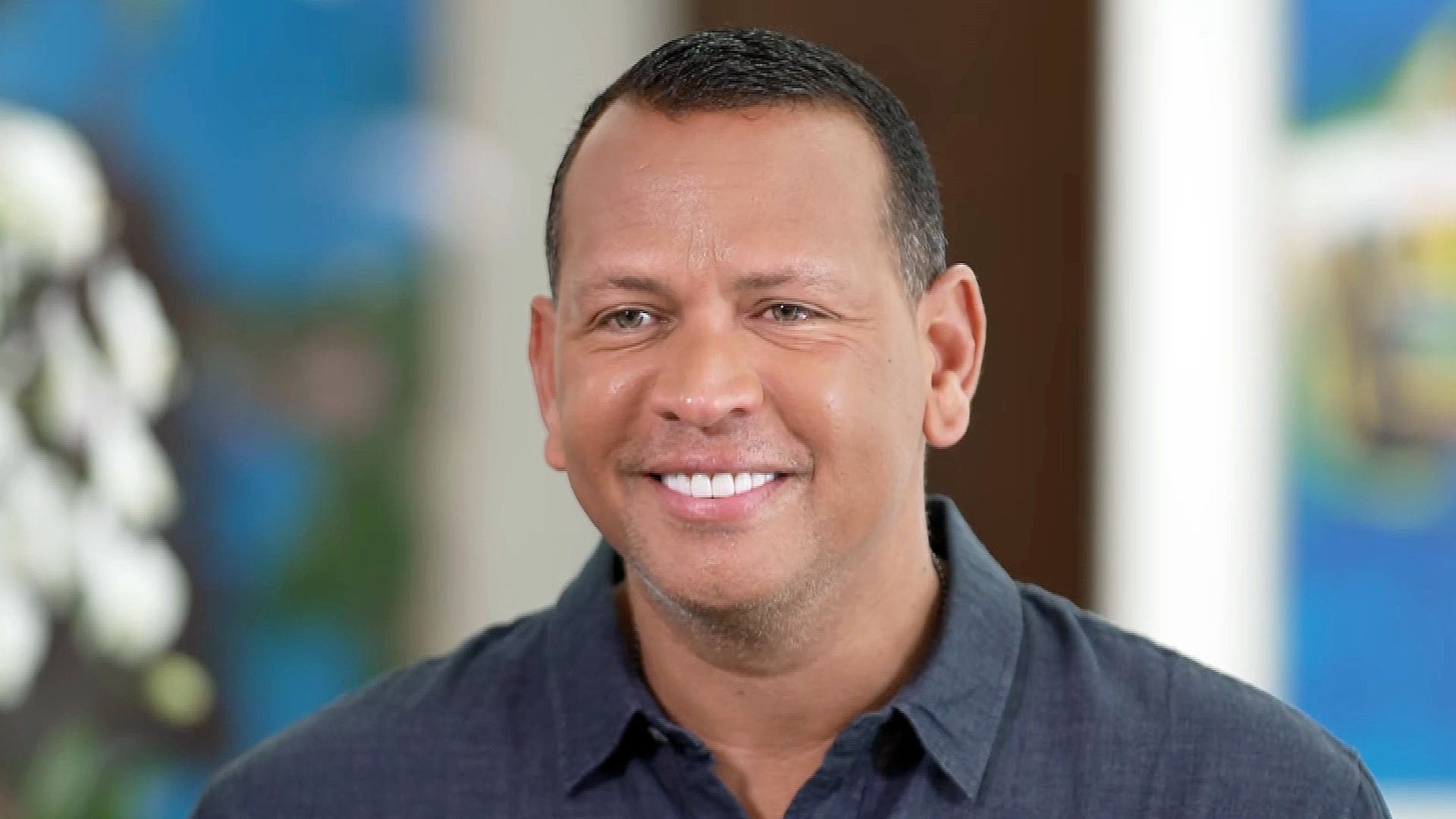 Alex Rodriguez Hair Transplant